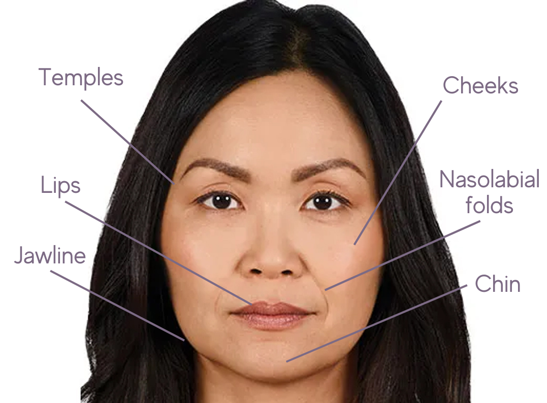 Your Cosmetic Injection Site Cheat Sheet - Radiance Skincare & Laser Medspa